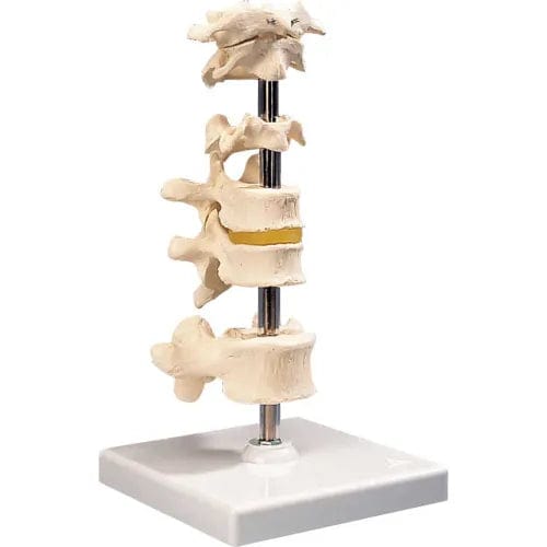 Anatomical Model - 5 Mounted Vertebrae with Removable Stand– Centerline Dynamics